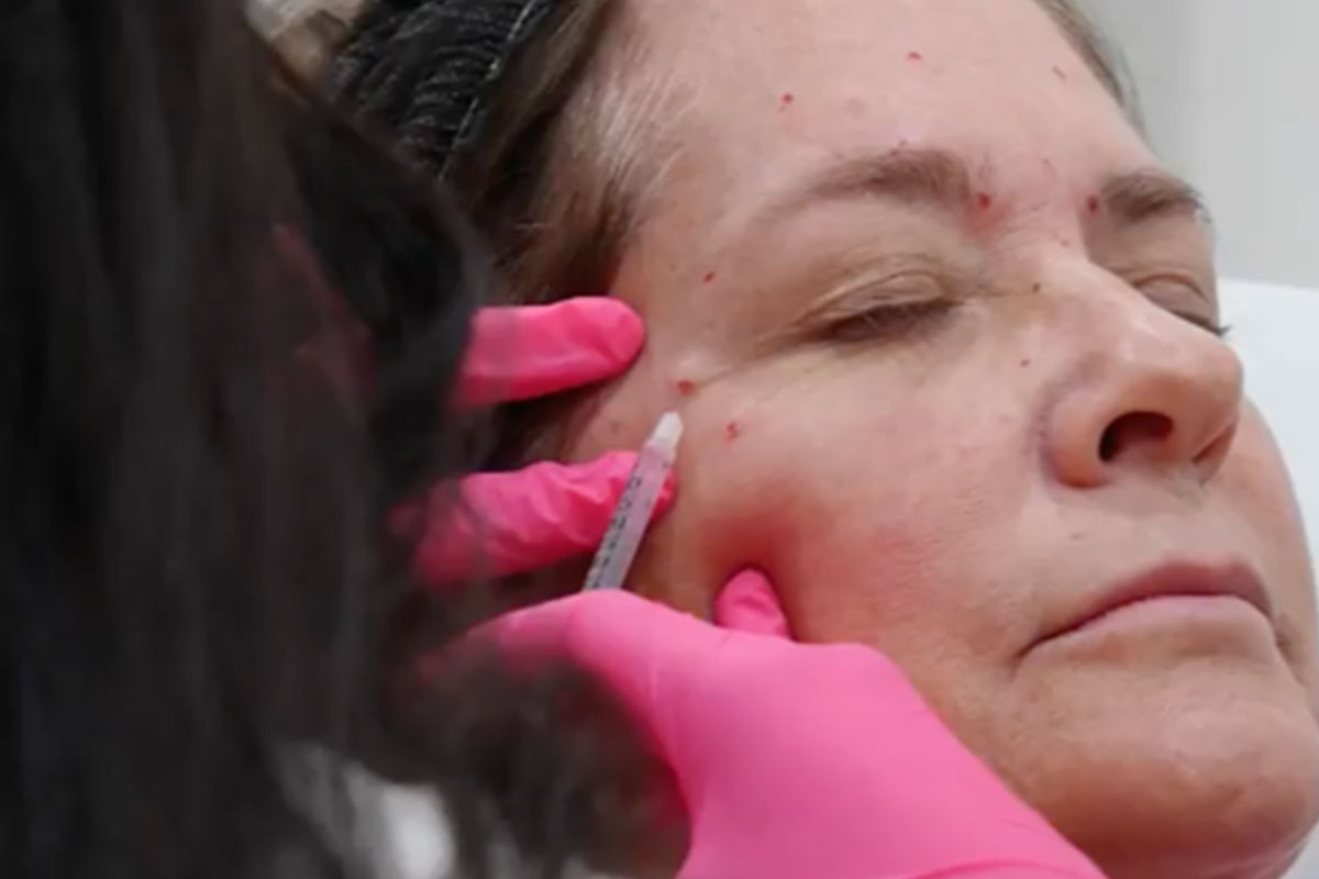 Botox Training in Los Angeles, CA | Infinity Med Spa